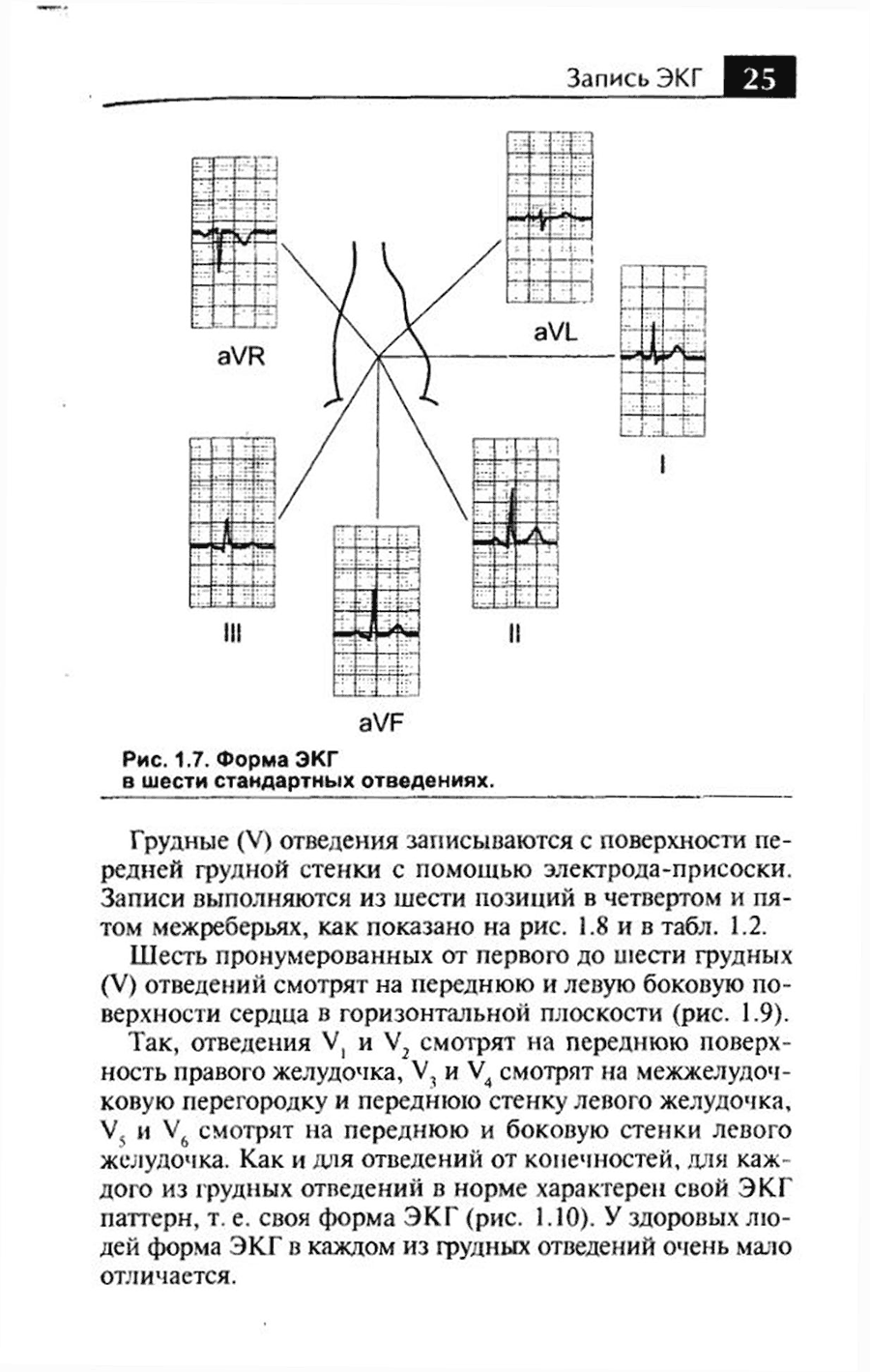 Книга "ЭКГ в практике врача". Книга по расшифровки ЭКГ.