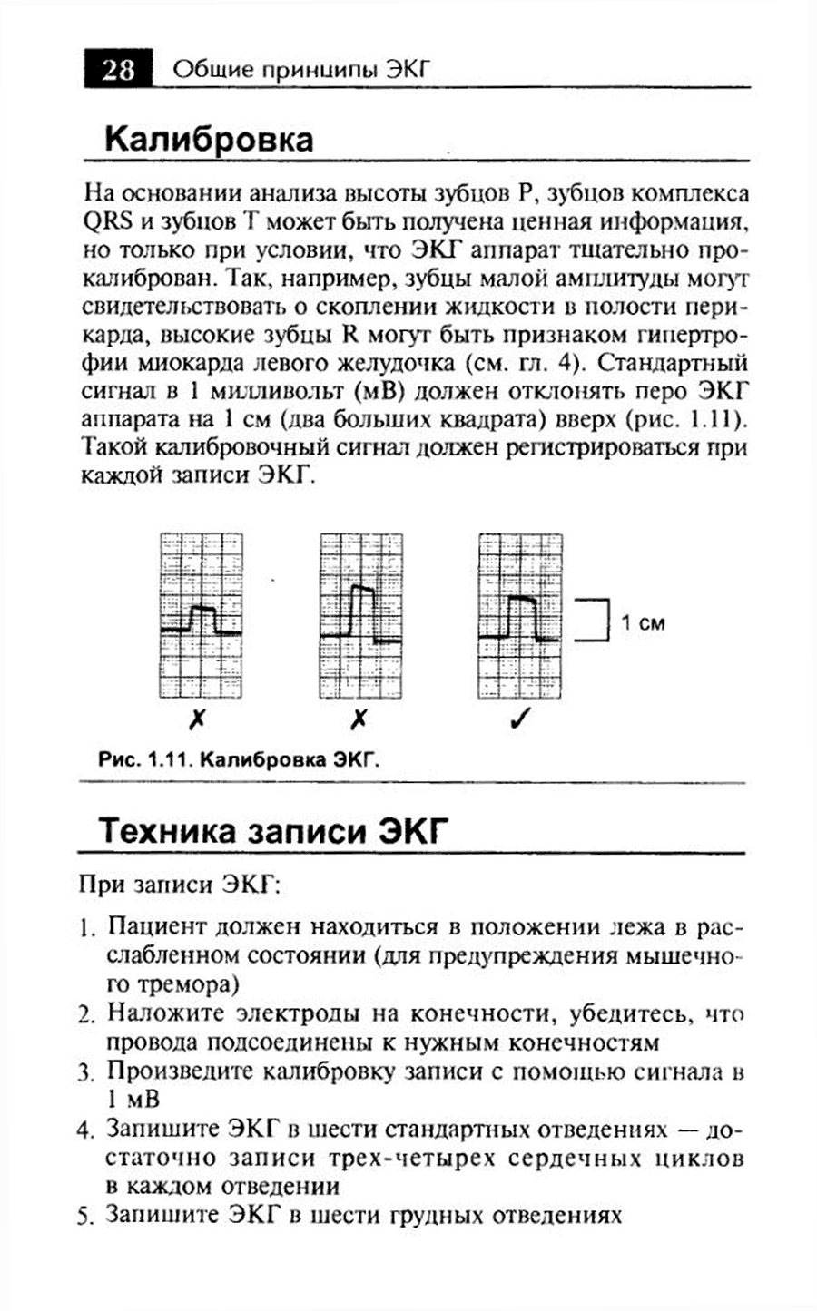 Книга "ЭКГ в практике врача". Книга по расшифровки ЭКГ.