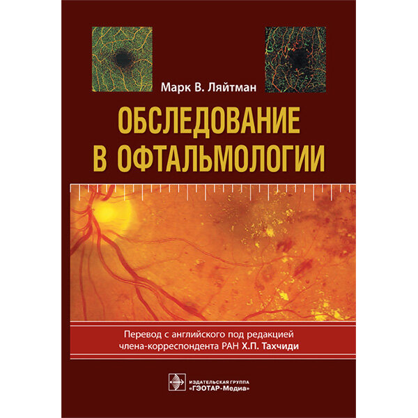 Книга "Обследование в офтальмологии". Купить медицинскую литературу по ...