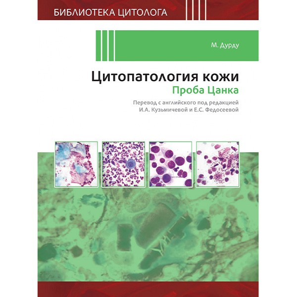Книга "Цитопатология кожи. Проба Цанка". Купить книги по цитологии в ...