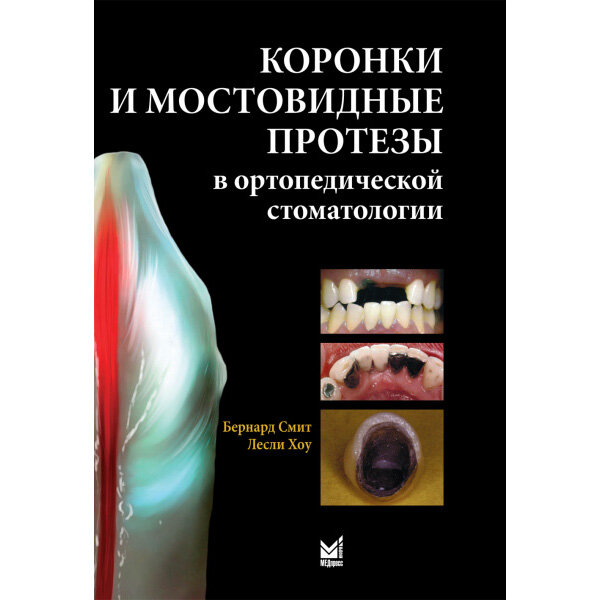Книга "Коронки и мостовидные протезы в ортопедической стоматологии ...
